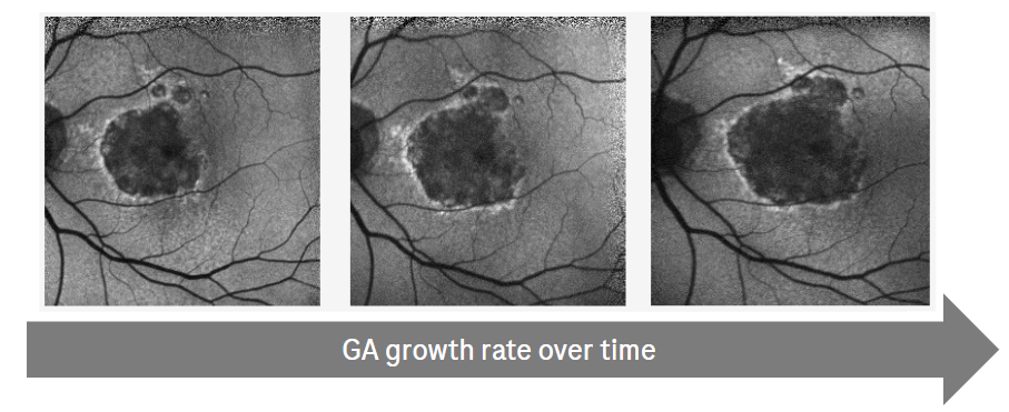 stats4datascience - How to get the most out of prognostic baseline ...